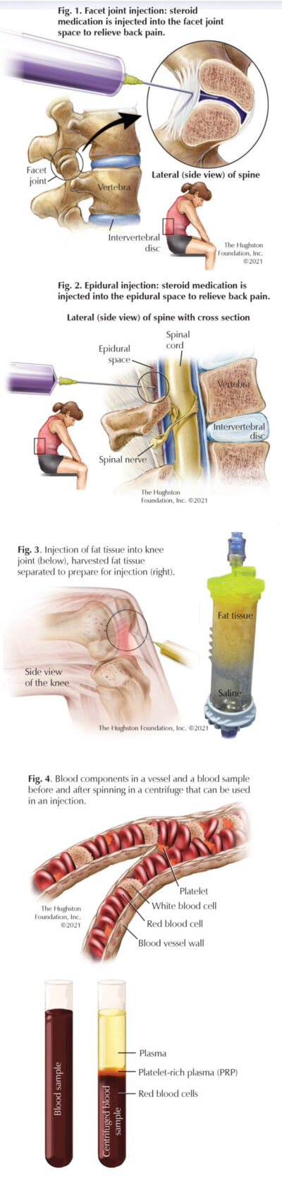 Interventional Pain Management: Questions for a Specialist - Florida